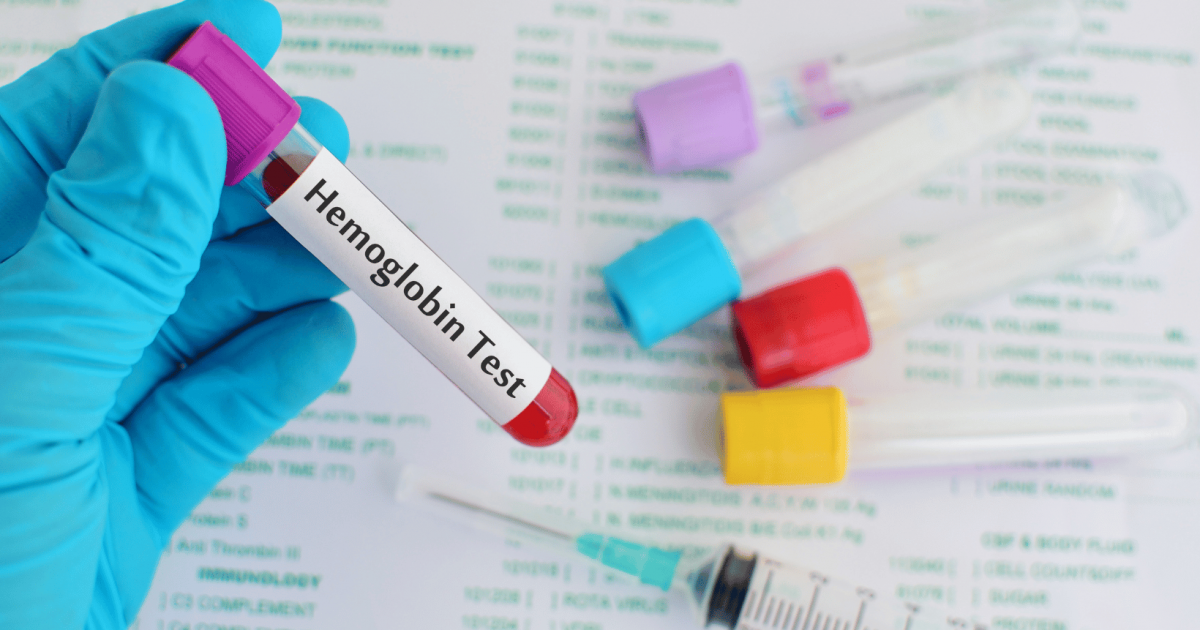 Hemoglobin - Trombózis- és Hematológiai Központ