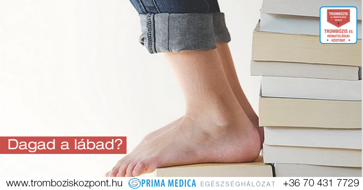 Bedagadt a lábam trombózis után! Mit tehetek?