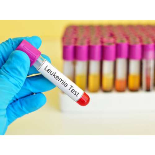 Leukémia a vérképen - Trombózis- és Hematológiai Központ