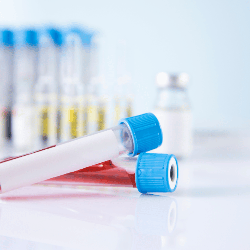 Monocita érték - Trombózis- és Hematológiai Központ