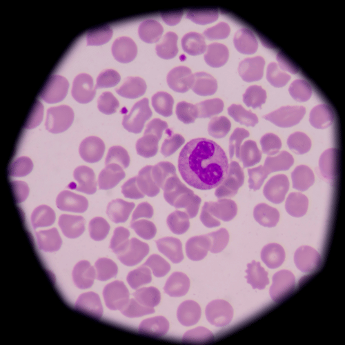 Neutrofil érték - Trombózis- és Hematológiai Központ